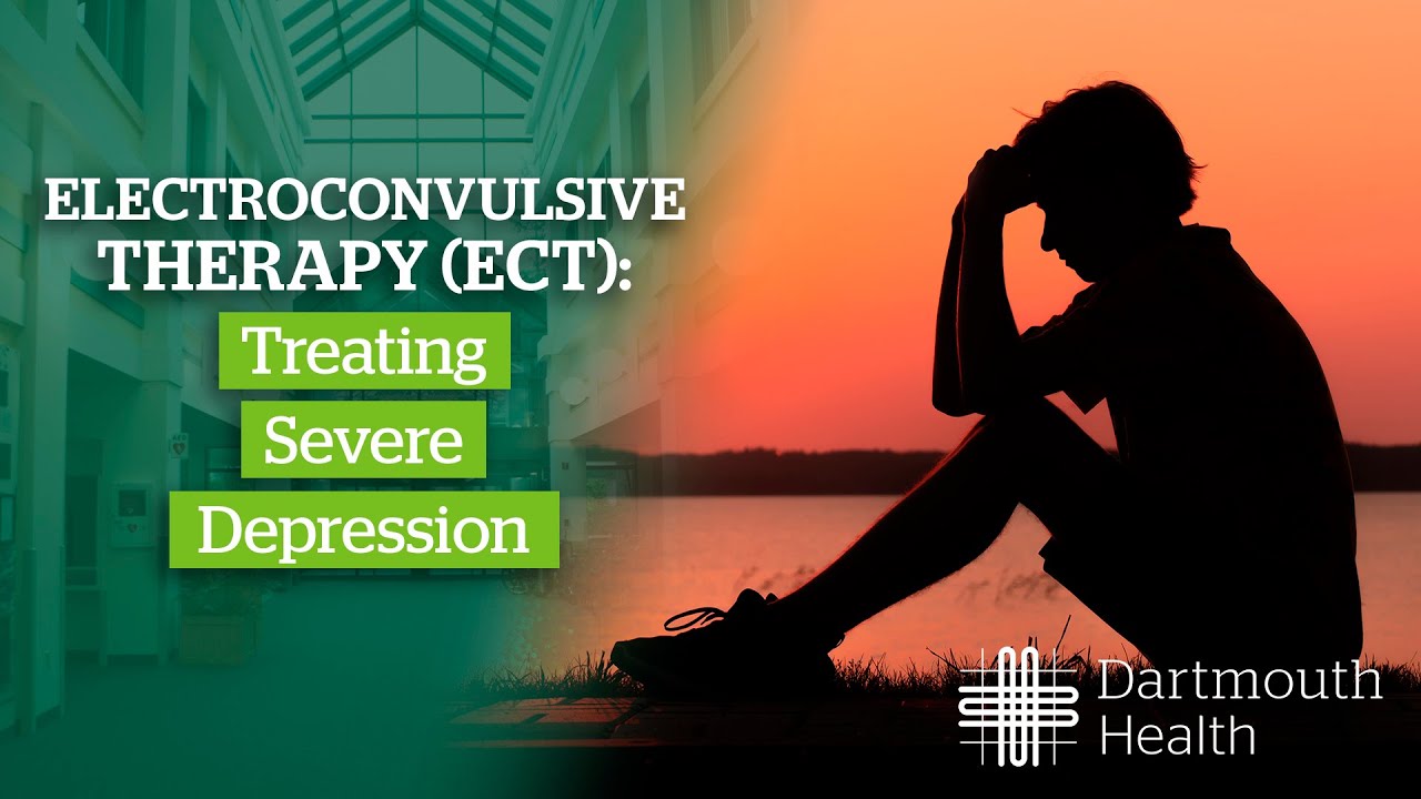 Electroconvulsive Therapy (ECT): Treating Severe Depression ...