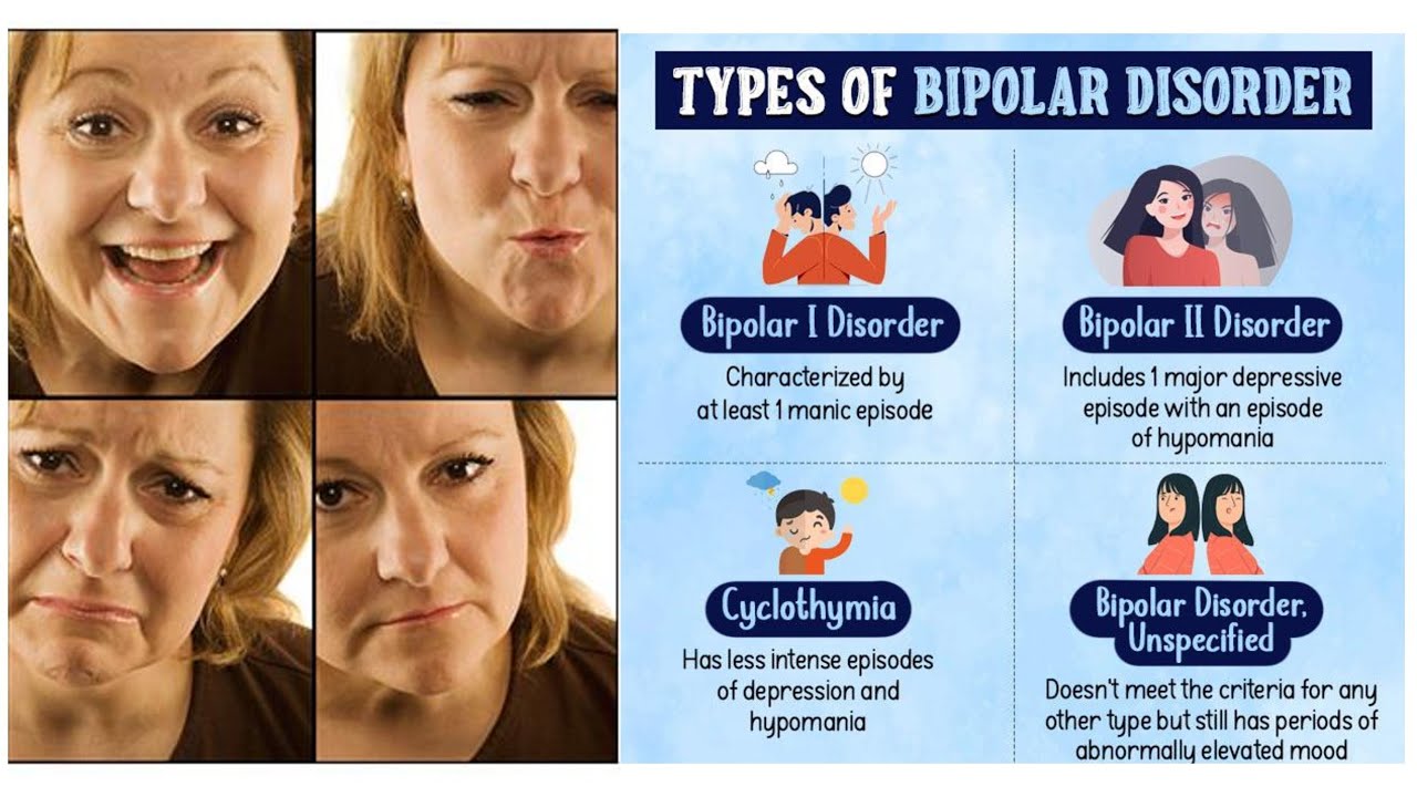 WESTERN DIAGNOSIS OF BIPOLAR DISORDER - Behavioral Healthcare Network
