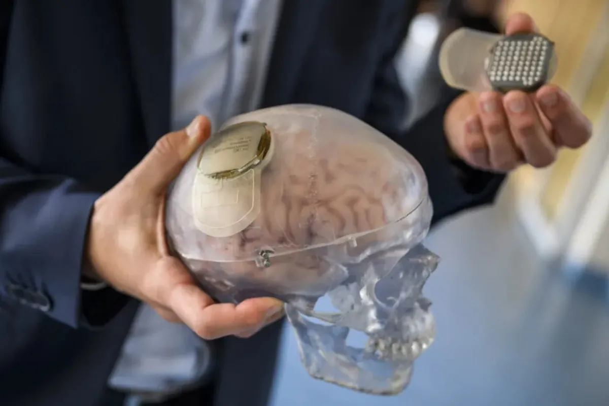 Chinese scientists revive brain that had been dead for 50 minutes ...