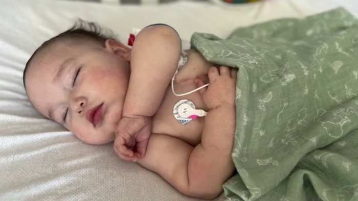 San Antonio family shares miraculous story of 1-year-old boy born with ...
