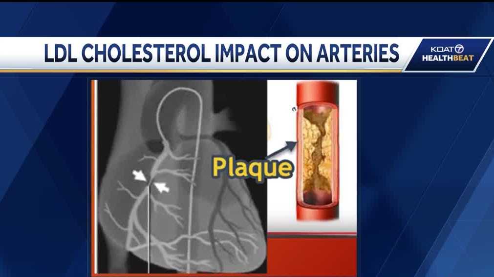 What is LDL cholesterol and how to treat it - Behavioral Healthcare Network