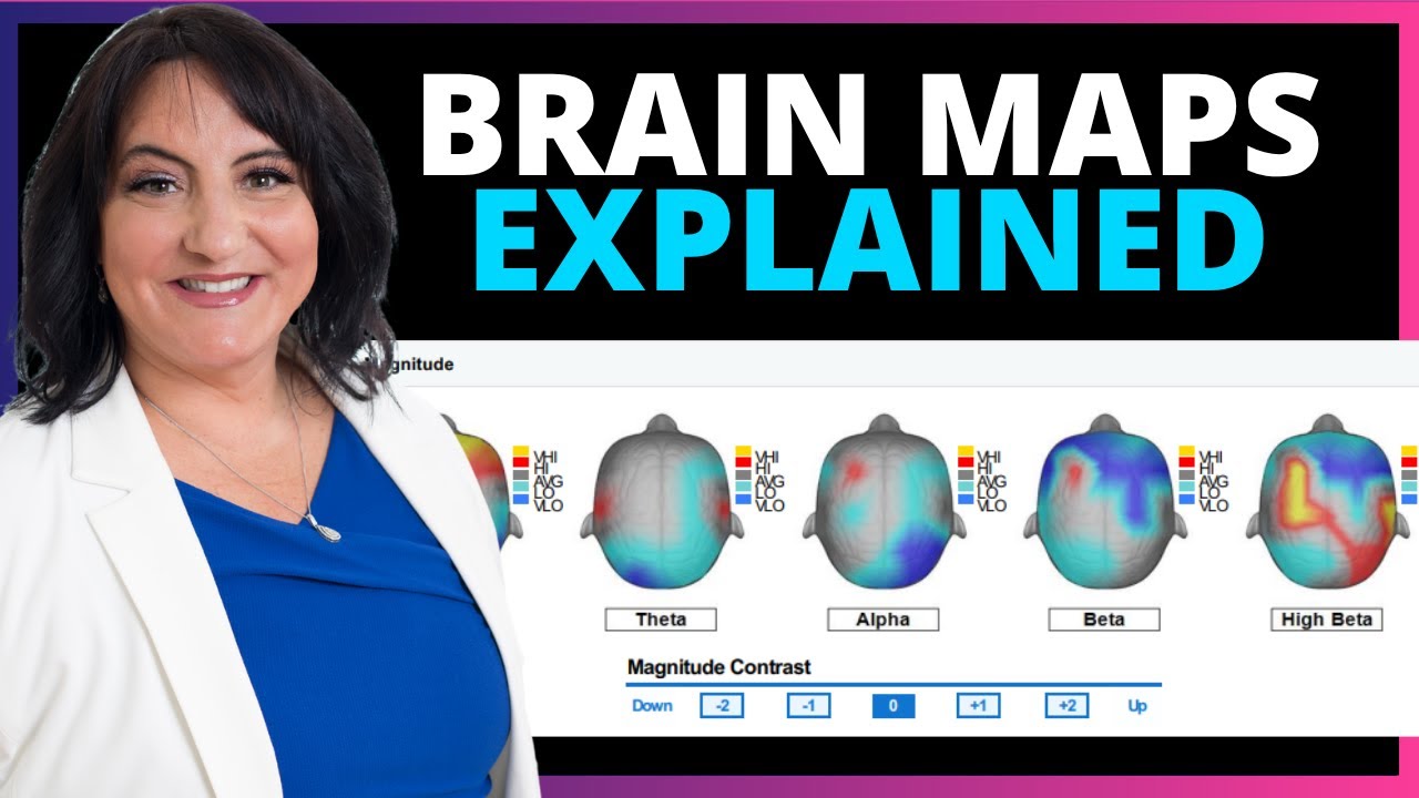 Why a Brain Map Could Be The Missing Link In Your Child's Diagnosis ...